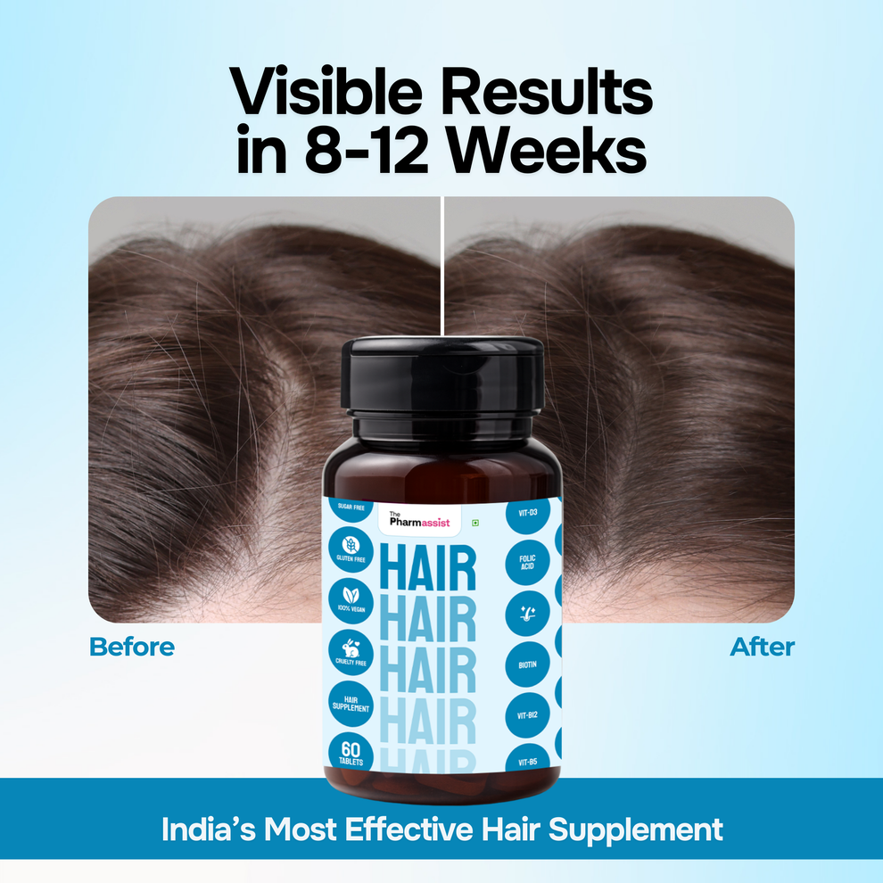 Hair Tablets – The Pharmassist